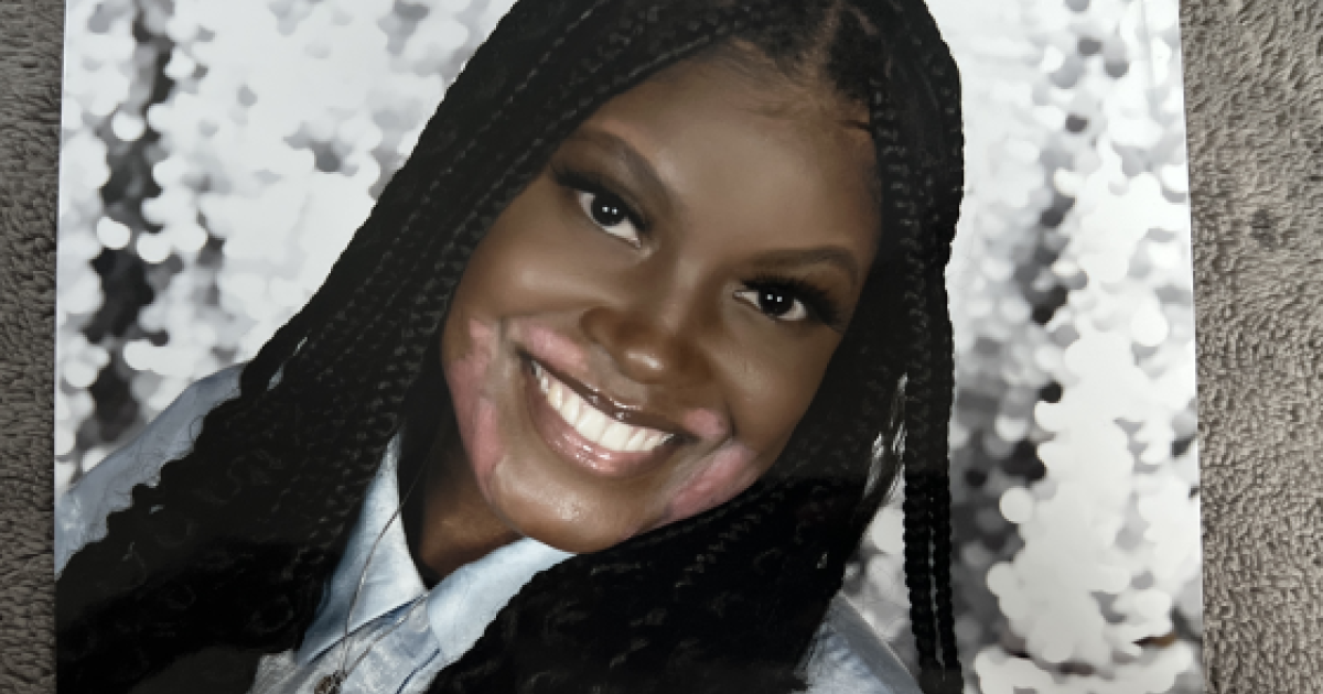 I'Dallys E. - Diagnosed at age 13 | Lupus Foundation of America