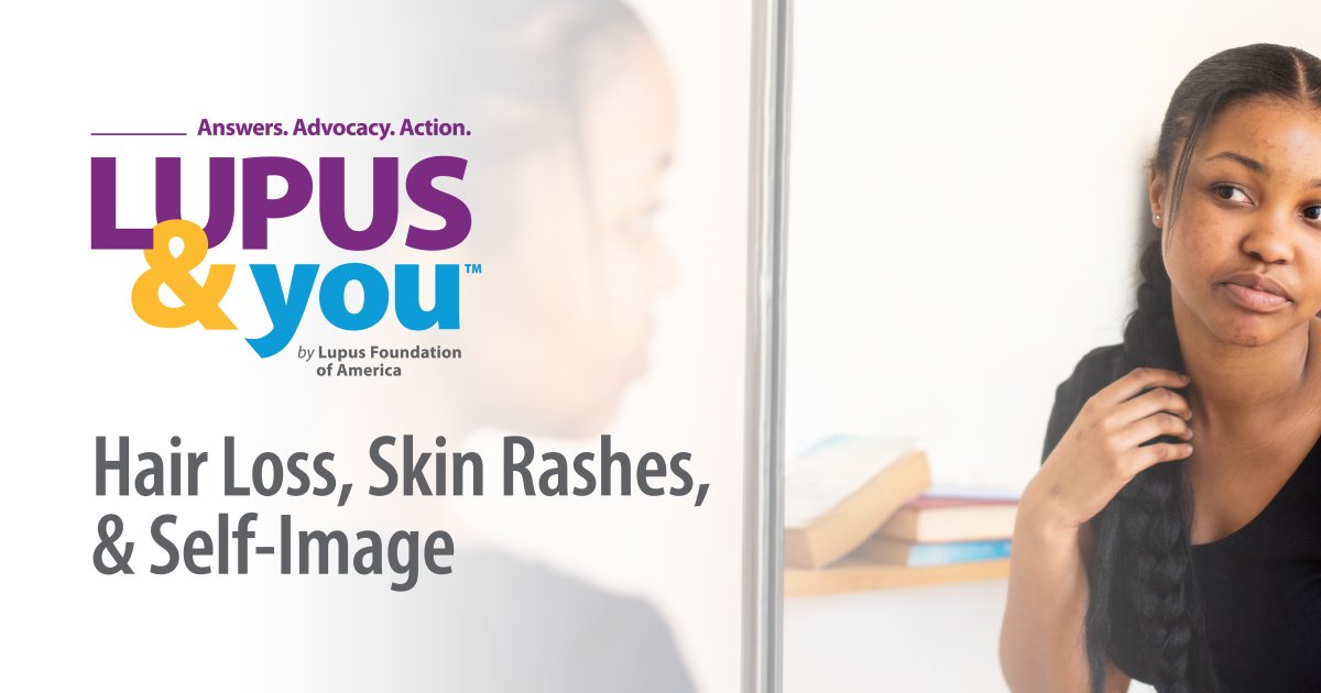 Event Resources from Lupus & You: Hair Loss, Skin Rashes, and Self ...