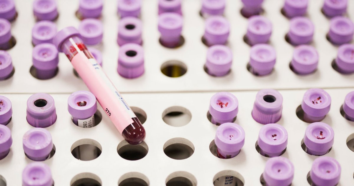 Cómo el lupus afecta a la sangre | Lupus Foundation of America