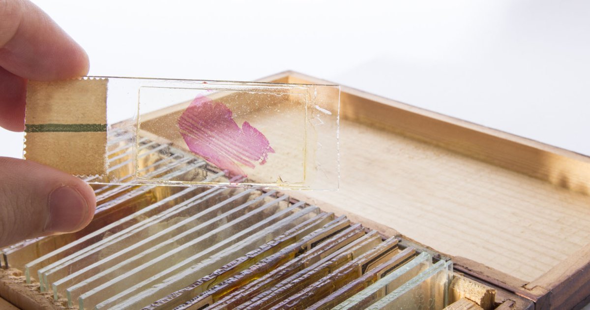 The History of Lupus | Lupus Foundation of America