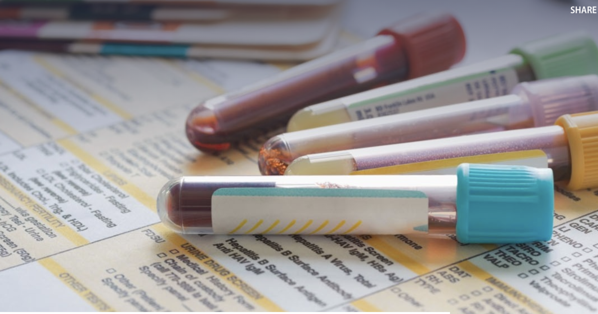 Diagnosing lupus | Lupus Foundation of America